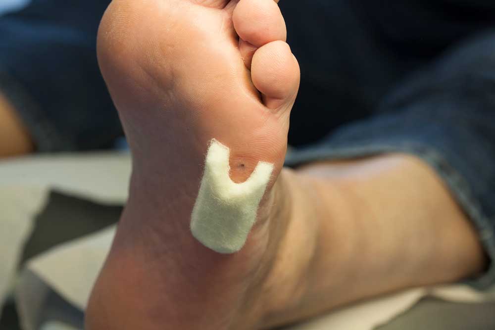 Fodbehandlinger og priser | Lisbjerg Fodterapi